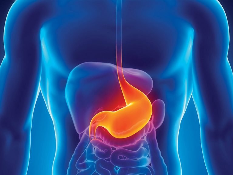 Você sabe o que é refluxo gastroesofágico? – Valéria Leal